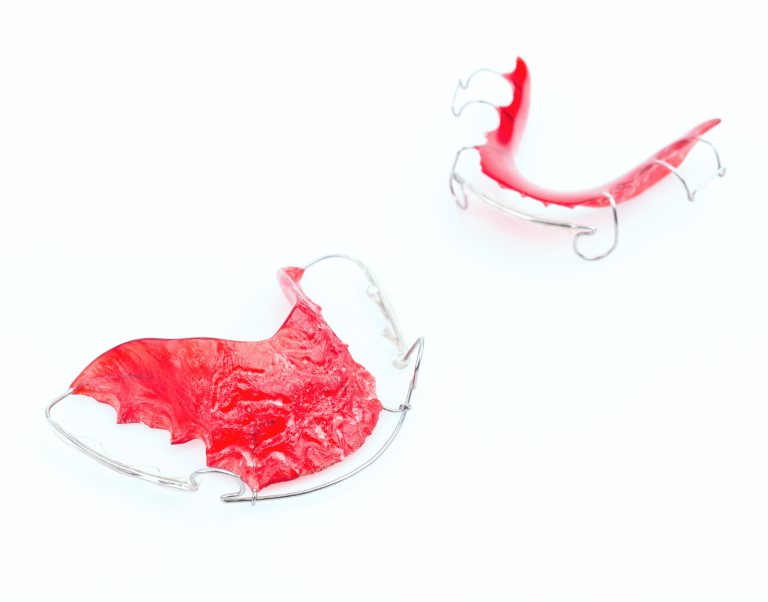 What Are Metal Retainers?